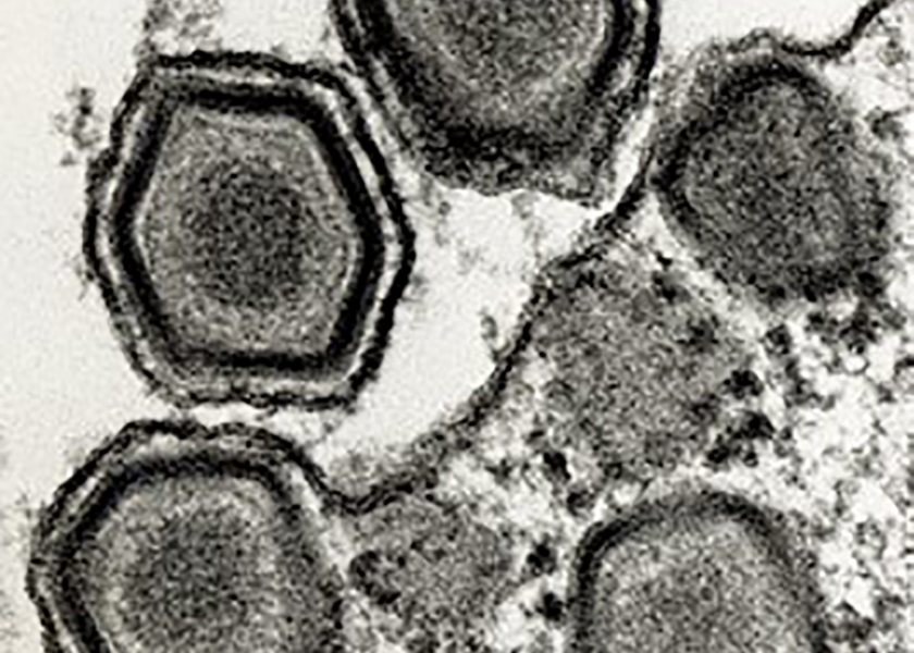 New China African Swine Fever Strains Point to Unlicensed Vaccines ...